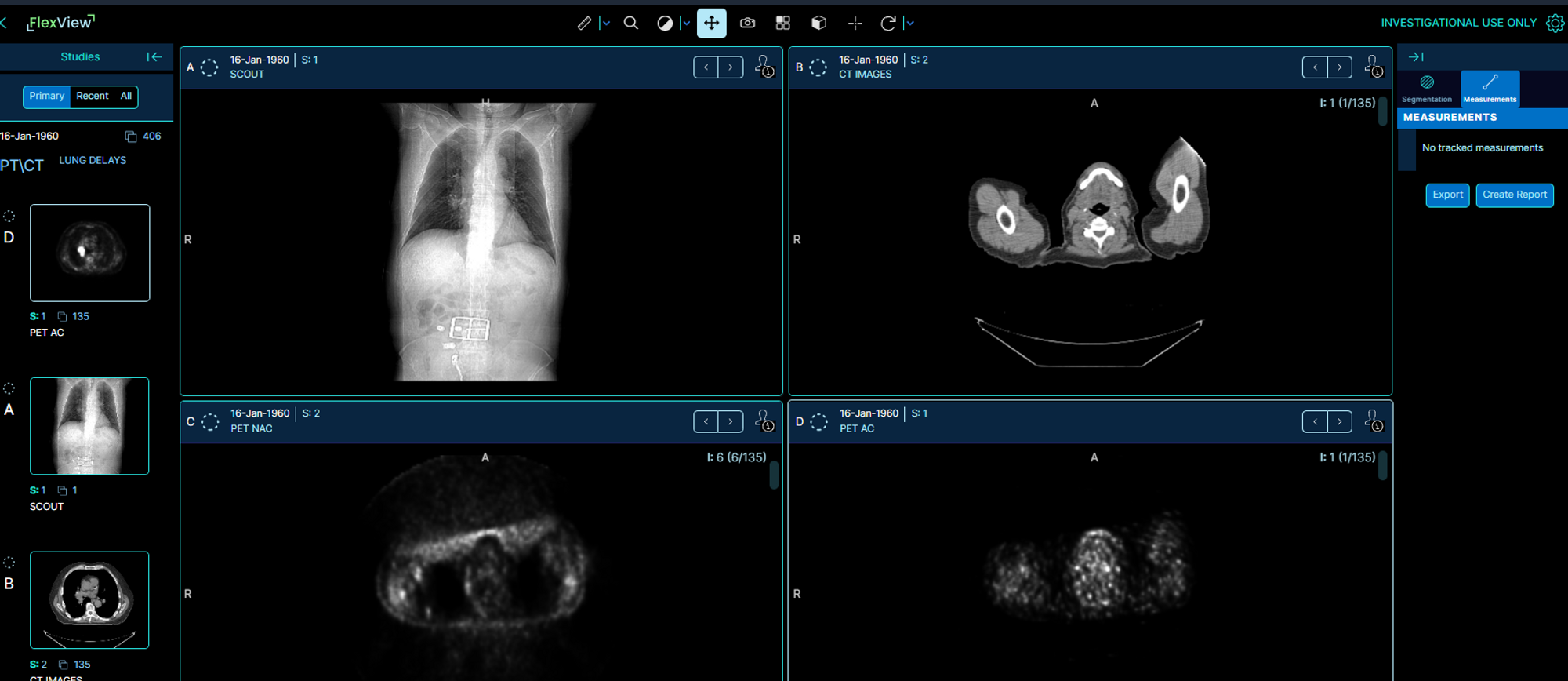 Viewport – FlexView User Guide