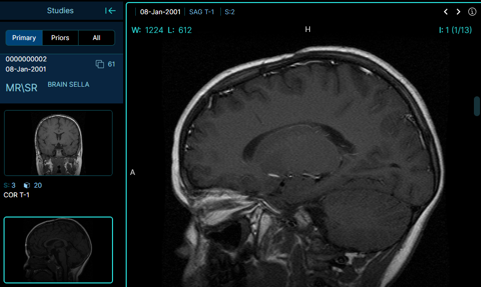 Viewport – FlexView User Guide