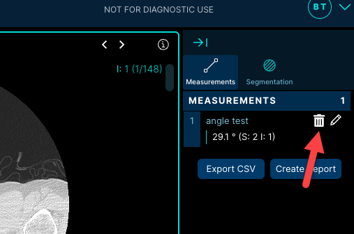 Measurement Panel – FlexView User Guide